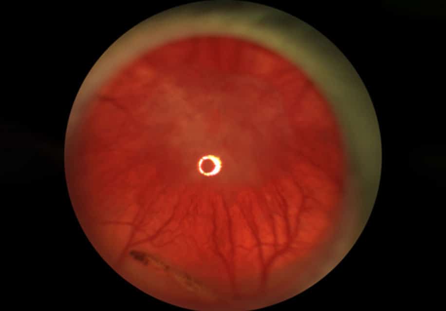 Ophthalmology Models | Ichor Life Sciences