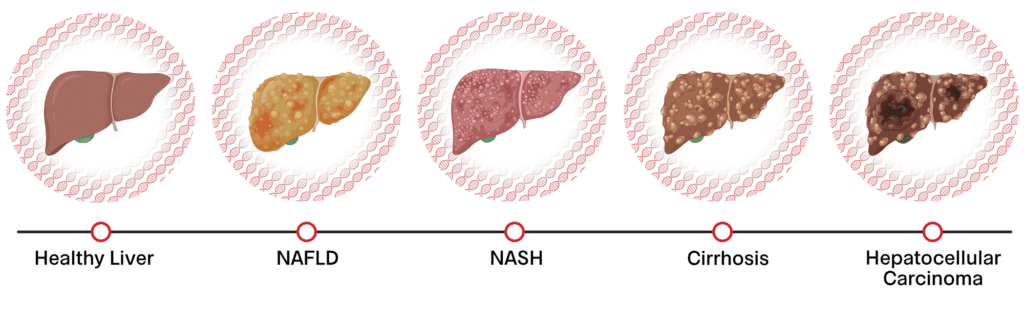 NASH Mouse Model | Ichor Life Sciences