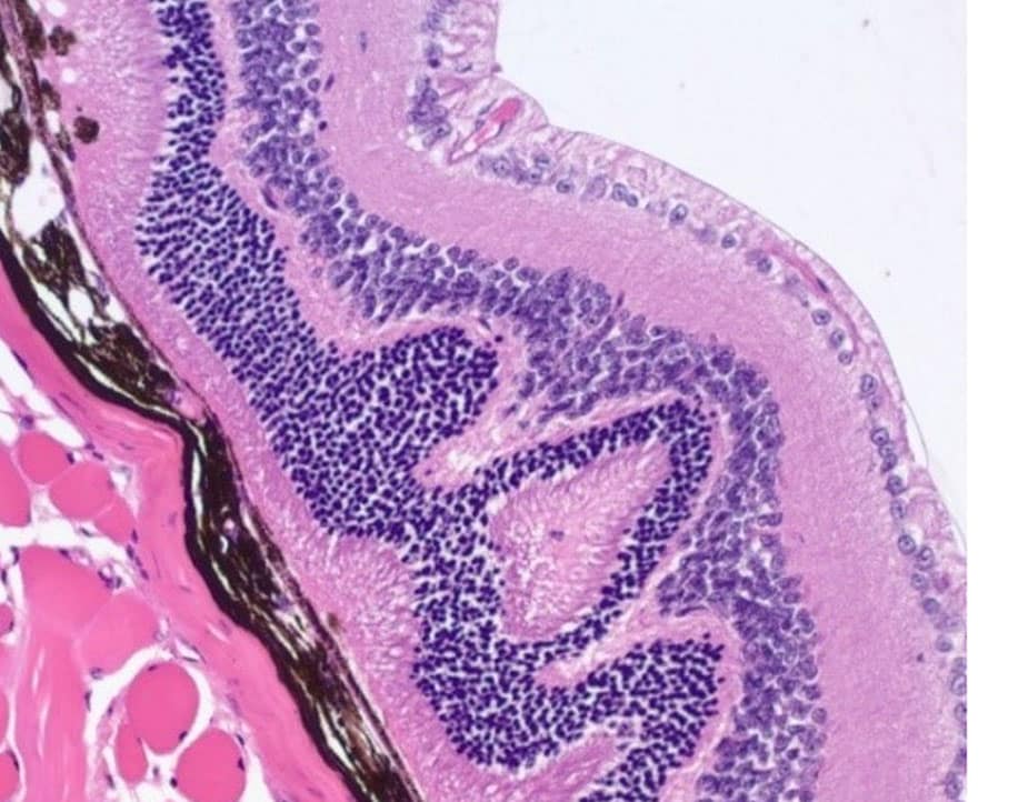 Stargardt Disease Research Model | Ichor
