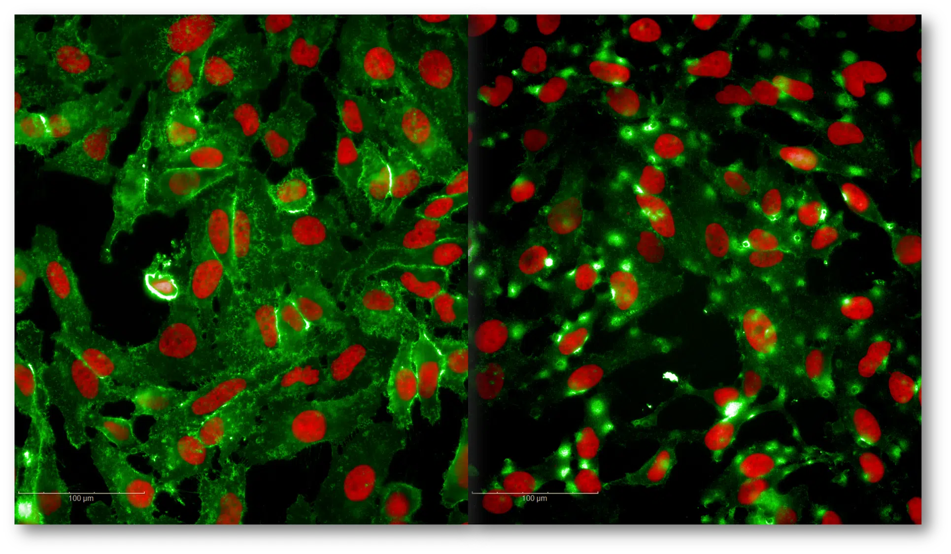 High-Content Receptor Internalization Assays | Ichor Life Sciences